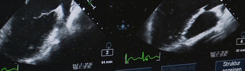 Leasing Urządzeń USG - Master Leasing